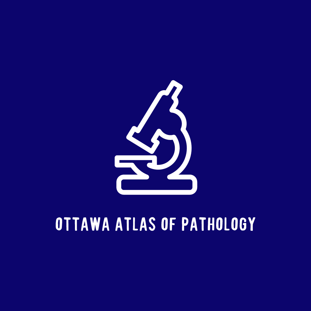 margins Archives | Atlas of Pathology