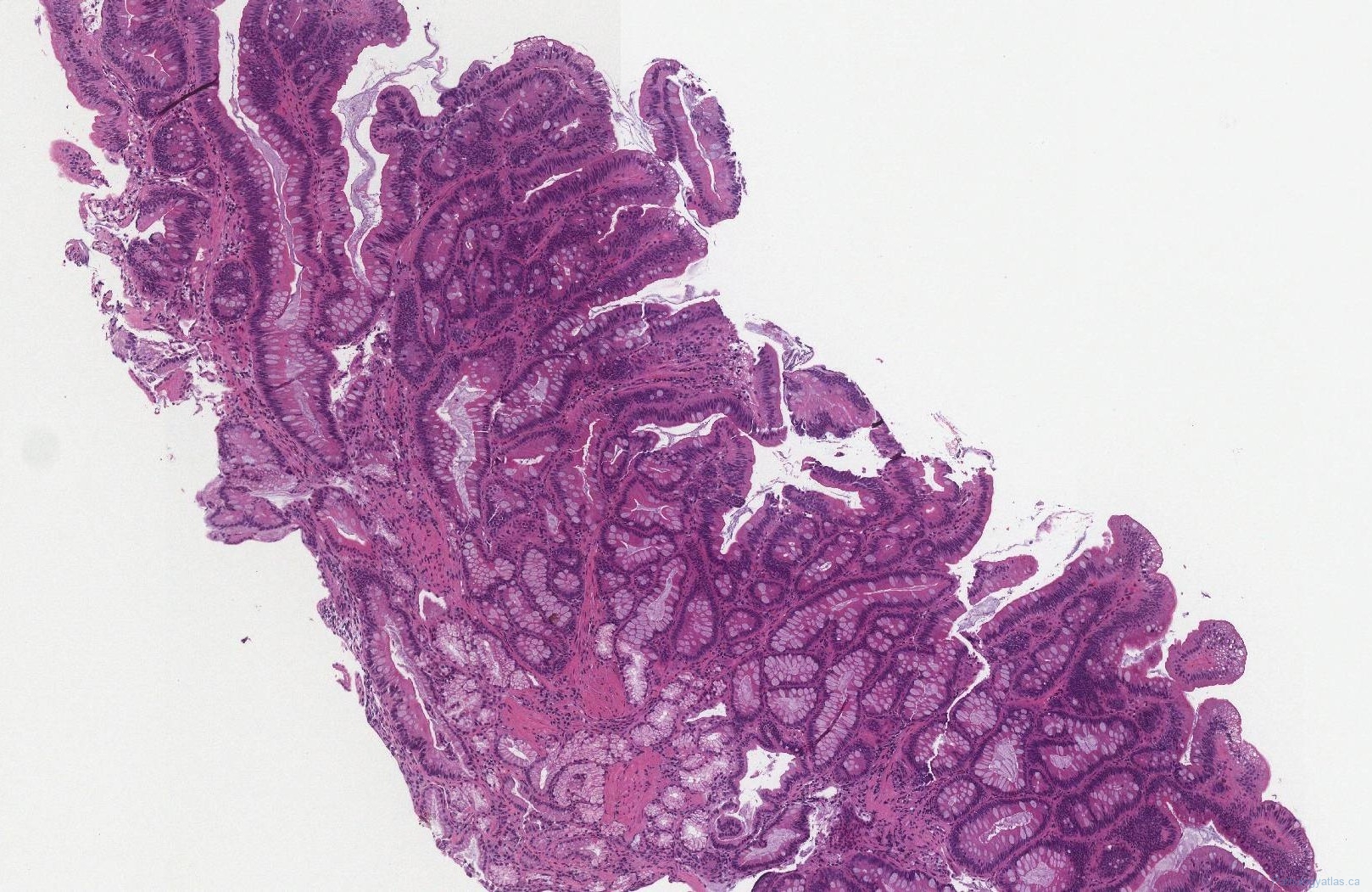 Duodenal Ampulla Histology